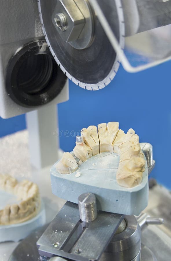 Plaster Cast of Front Teeth Stock Image - Image of fabrication, model ...