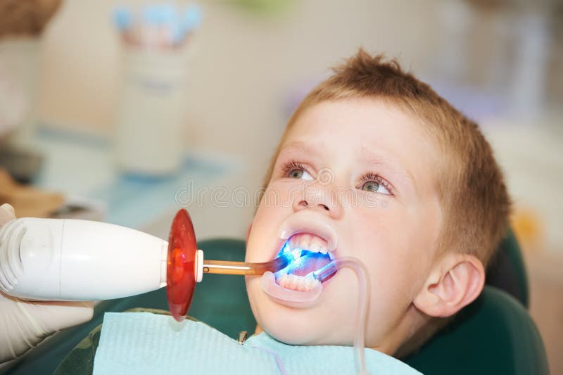Dental Filing of Child Tooth by Stock Photo - Image of curing ...