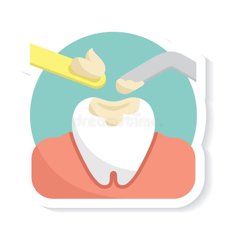 Dental Filling on Tooth. Vector Illustration Decorative Design Stock ...