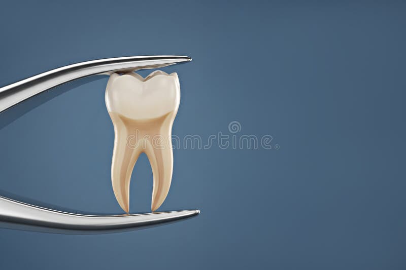 Dental Forceps Holding a Tooth Against Blue Background Withy Copy Space ...