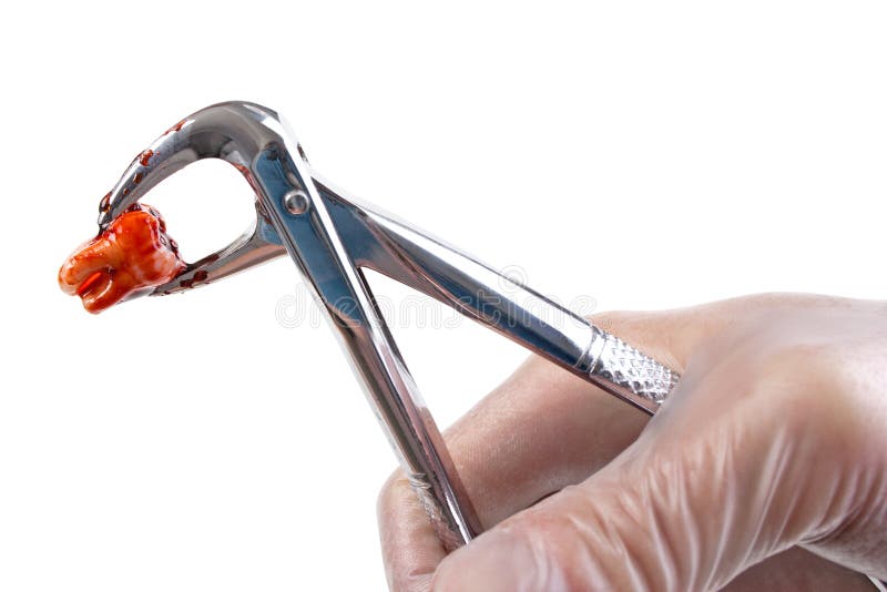 Dental forceps and tooth stock photo. Image of tool, hand - 21014948