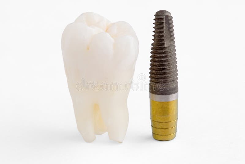 Wisdom Tooth, Implant and Teeth Model Stock Image - Image of equipment ...