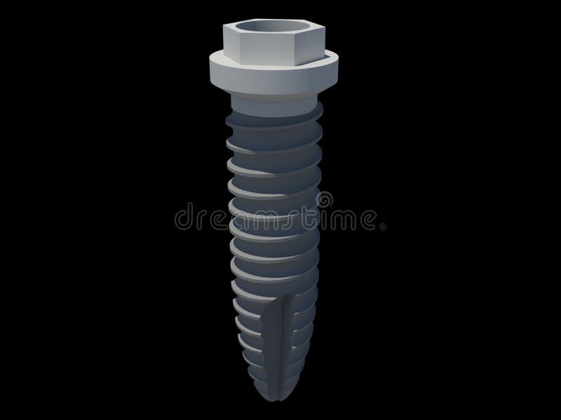 Dental Implant External Hexagon Stock Illustration - Illustration of ...