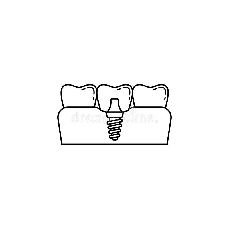 Dental implant line icon stock vector. Illustration of dentist - 89545364
