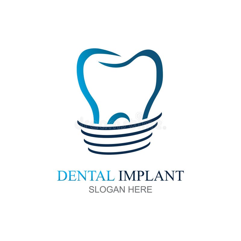 Dental Implant Logo Design Concept Vector, Dental Care Logo Template ...