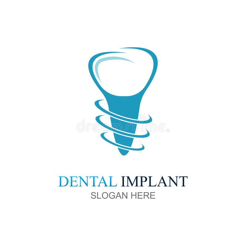 Dental Implant Logo Design Concept Vector, Dental Care Logo Template ...