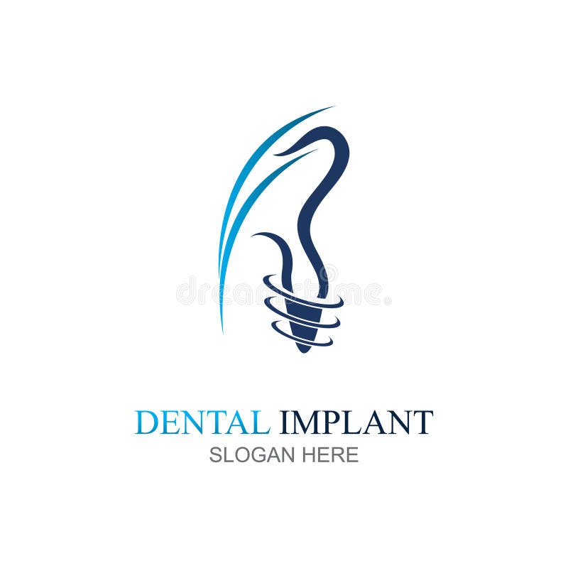 Dental Implant Logo Design Concept Vector, Dental Care Logo Template ...