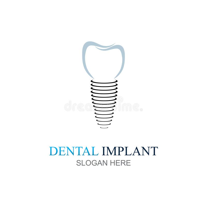 Dental Implant Logo Design Concept Vector, Dental Care Logo Template ...