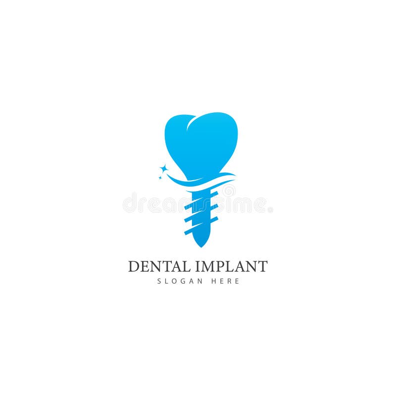 Dental Implant Logo Design Concept Vector Dental Care Logo Template ...