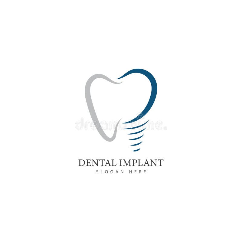 Dental Implant Logo Design Concept Vector Dental Care Logo Template ...