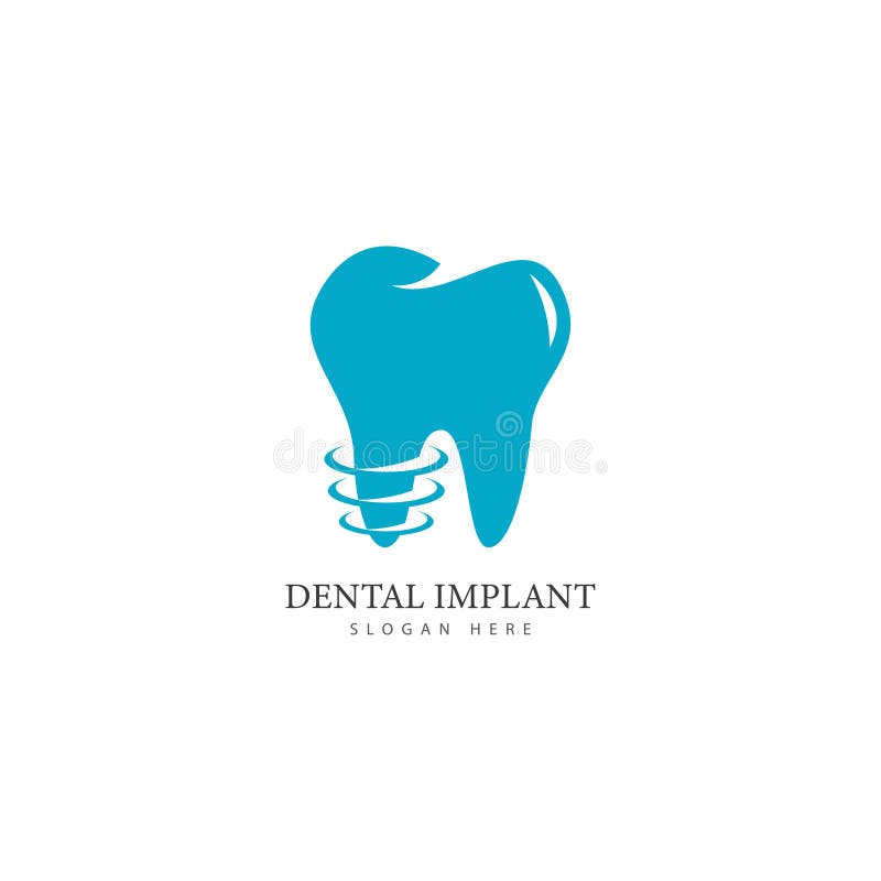 Dental Implant Logo Design Concept Vector Dental Care Logo Template ...