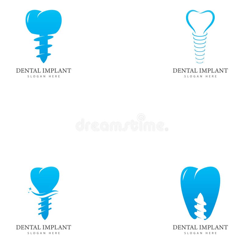 Dental Implant Logo Design Concept Vector Dental Care Logo Template ...