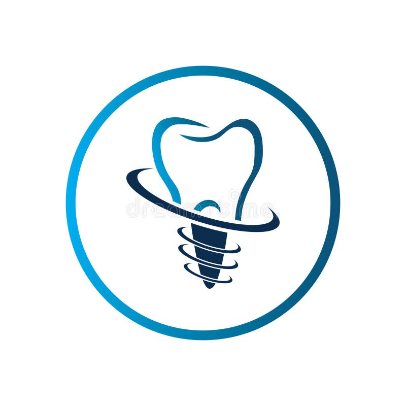 Dental Implant Logo Design Concept Vector, Dental Care Logo Template ...