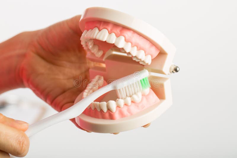 Dental implant model stock image. Image of medical, smile - 69813331