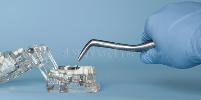 Dental Implant Model with Surgical Tool Stock Photo - Image of care ...