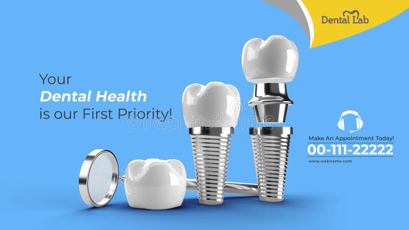 Dental Implants Surgery Concept Horizontal Banner Template Stock ...