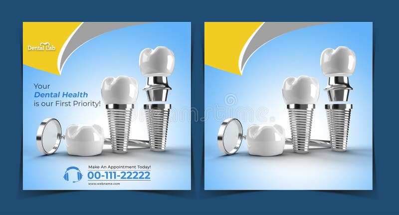 Dental Implants Surgery Concept Instagram Post Banner Template Stock ...