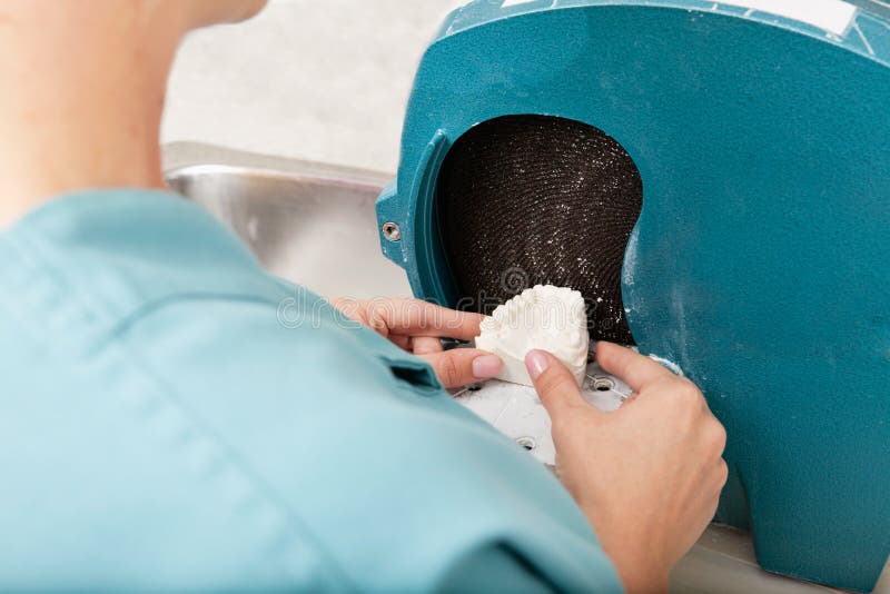 Dental Impression Cast stock image. Image of female, dental - 16591099