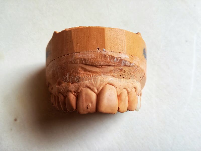 A dental impression stock image. Image of plaster, incisors - 113754719