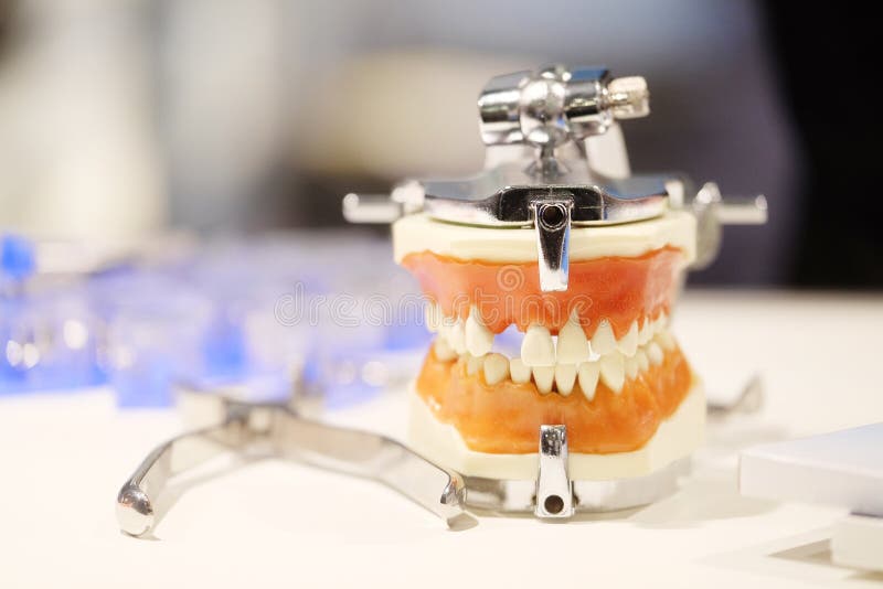 Dental jaw model stock photo. Image of orthodontic, denture - 53723130