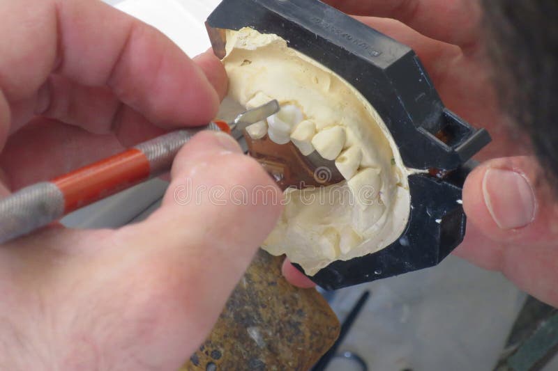 Dental Laboratory Equipment and Processing Stock Image - Image of ...