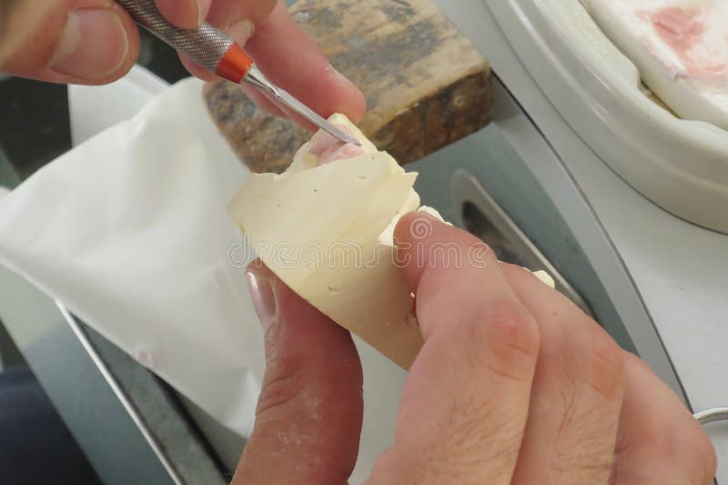 Dental Laboratory Equipment and Processing Stock Image - Image of ...