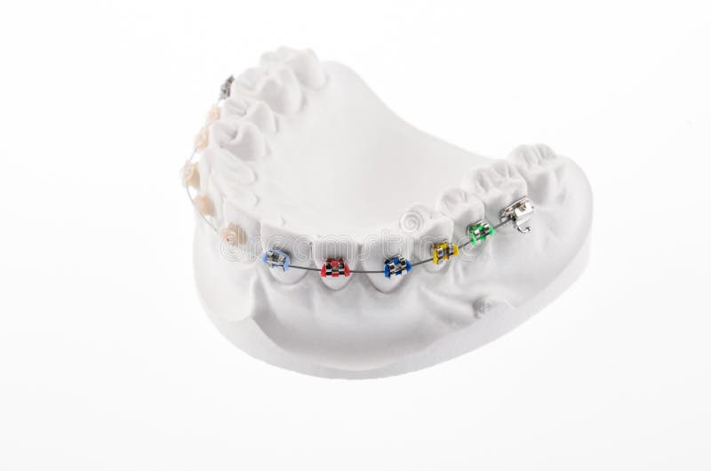 Dental lower jaw stock photo. Image of orthodontist, recovery - 28297036