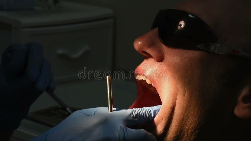 Dental Medical Examination and Treatment Stock Footage - Video of mouth ...