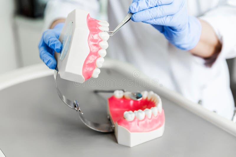 Dental Model Demonstration by Dentist Stock Image - Image of care, oral ...