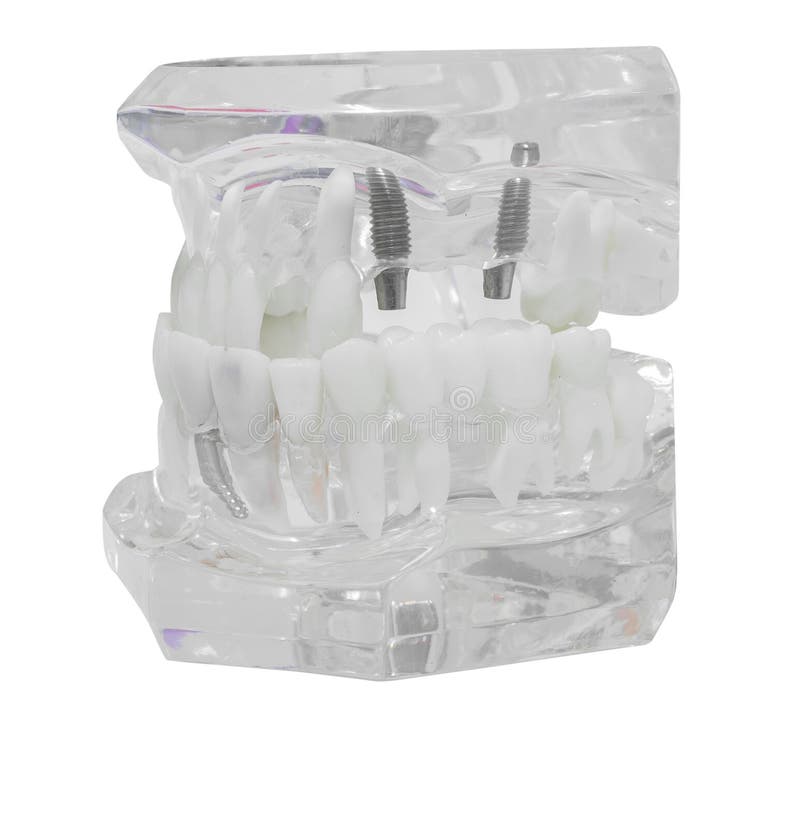 Dental Model Plastic of Teeth Transparent Stock Image - Image of dental ...