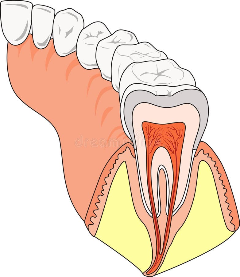 Model Of Teeth And Dental Implant Stock Illustration - Illustration of ...