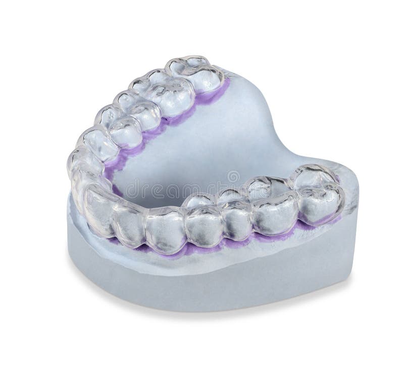 Dental Mold Impression for Tooth Braces Rack Model Stock Photo - Image ...