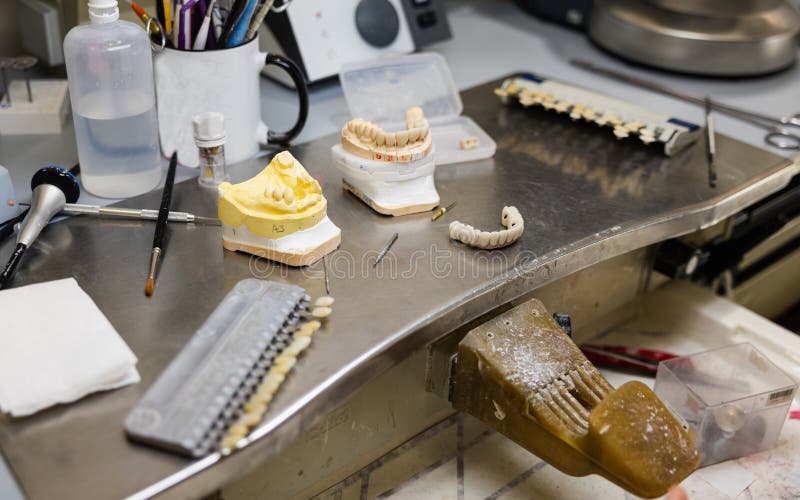 A Dental Office with a Table Full of Dental Tools and Materials Stock ...