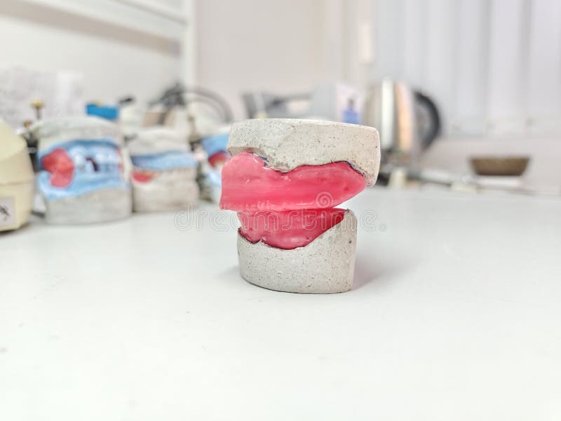 Dental Plaster Models with Denture Analogs in the Dental Laboratory Stock Photo - Image of ...