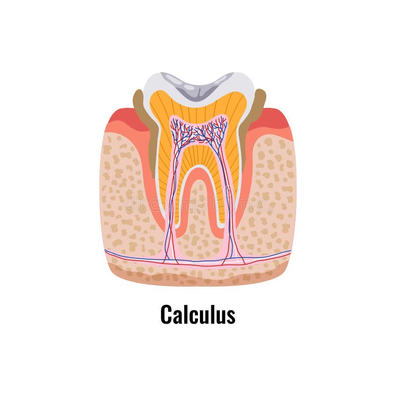 Dental Problem Poster stock vector. Illustration of infographic - 226694212