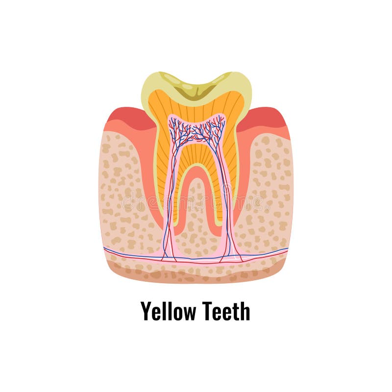 Dental Problem Poster stock vector. Illustration of organ - 226697795