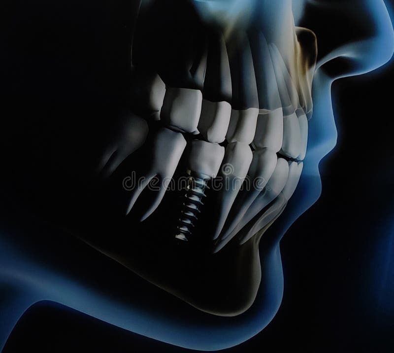 Dental Problems and Tooth Diseases Infographic Stock Vector ...