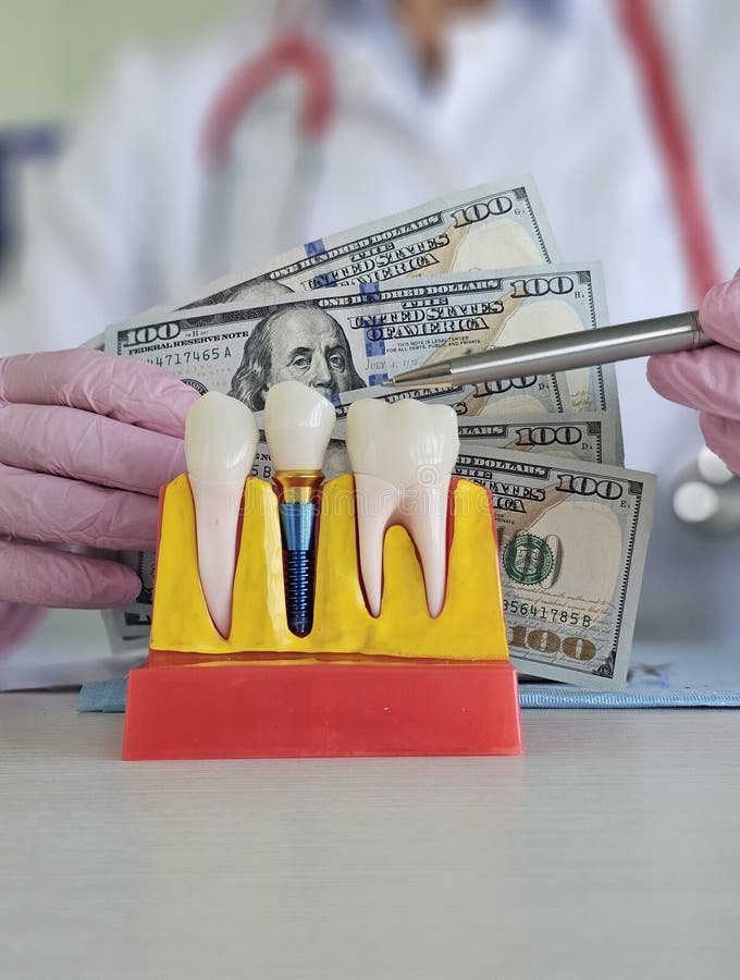 Dental Procedure Involving Implants and Money Exchange for Services ...