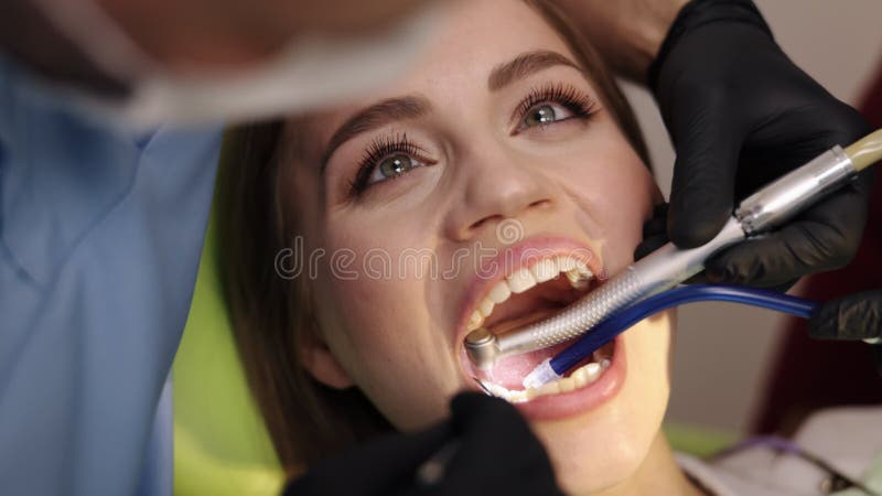 Dental Procedure, Dental Teamwork, Dental Office Stock Video - Video of dental, tools: 319288219