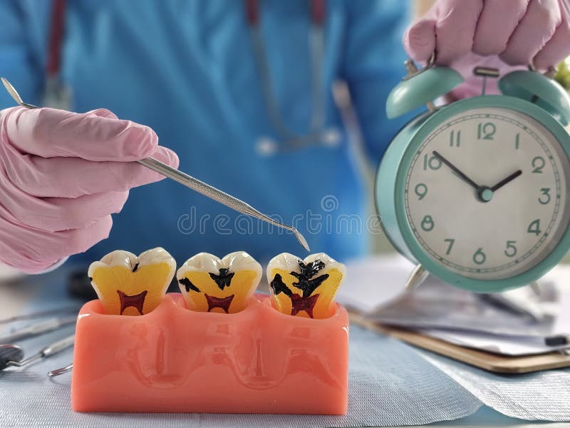 Dental Professional Demonstrating Cavity Filling Techniques with a ...