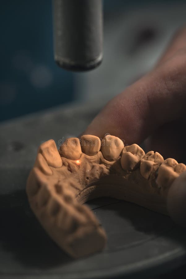 Dental Prosthesis stock photo. Image of laboratory, arch - 86859156