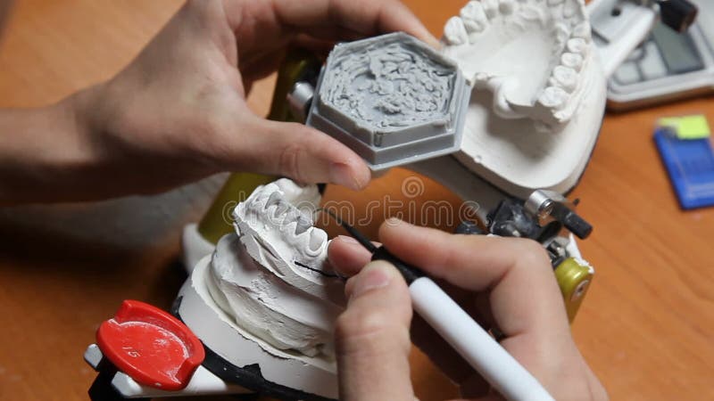 Dental Prosthesis, Dentures, Prosthetics Work. Stock Video - Video of ...