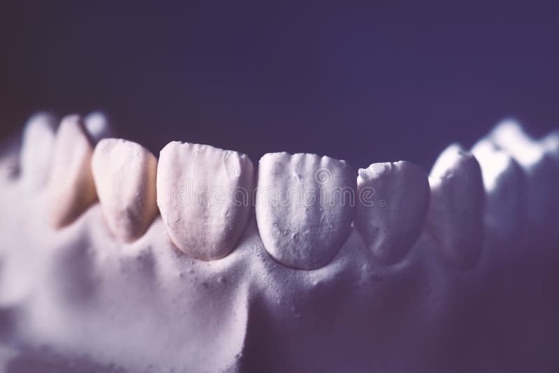 Dental Prosthesis Prosthetic Laboratory Stock Photo - Image of ...