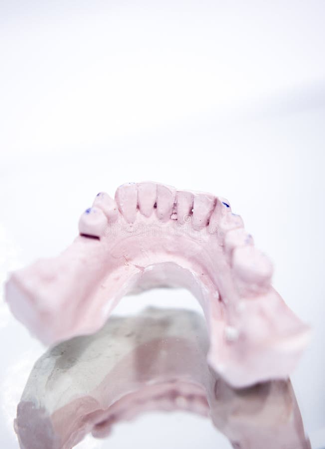 Dental Mold Dentist Clay Teeth Ceramic Plate Model Cast Stock Image ...