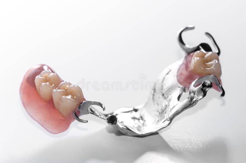 Dental prothesis stock photo. Image of teeth, dentist - 30388146