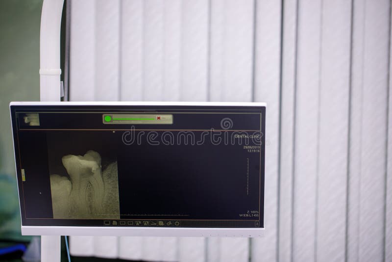 Dental X-ray on Computer Screen, Isolated Dentist Office. X-rays that ...