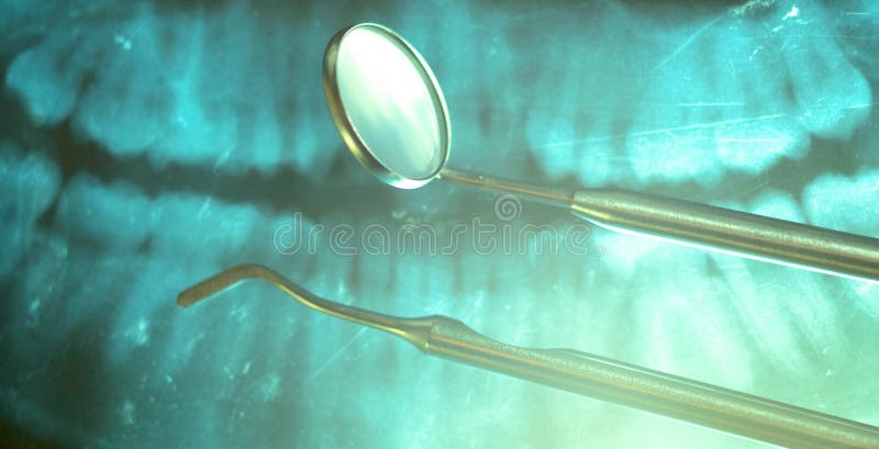 A Dental X-ray Film on White Stock Photo - Image of closeup, care: 93474966