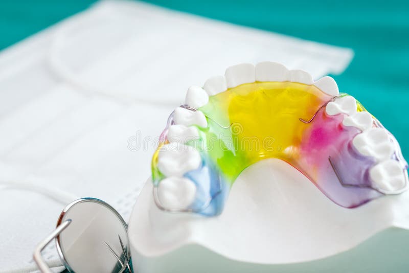 Dental Retainer Orthodontic Appliance. Stock Image - Image of object ...