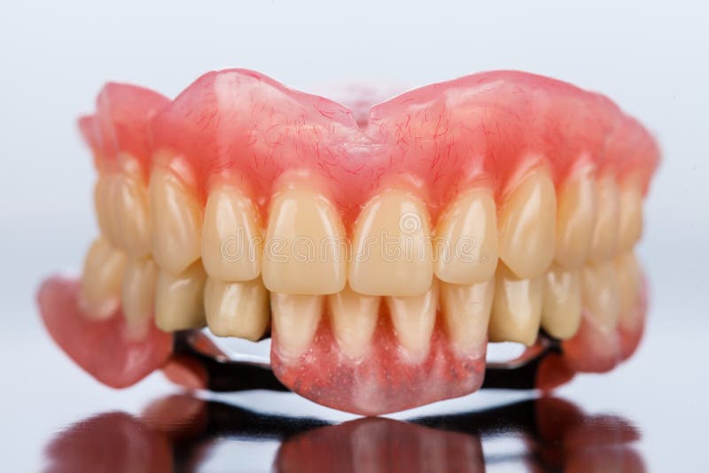 Dental Skeletal Prosthesis - Front View Stock Image - Image of ...