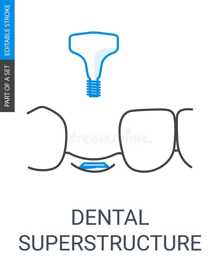 Superstructure Installation Stock Illustrations – 1 Superstructure ...